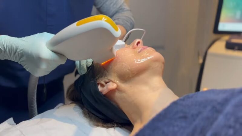 How Does Laser Treatment Work for Skin Rejuvenation? - Get Ldi