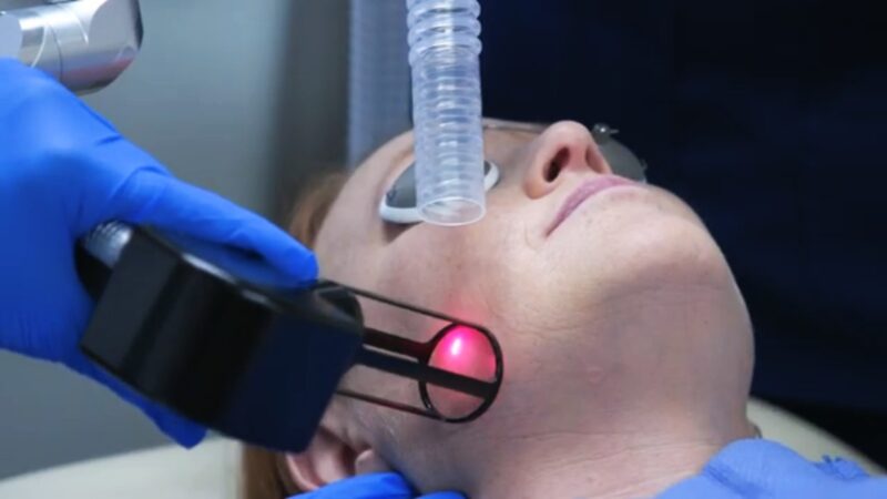 How Does Laser Treatment Work for Skin Rejuvenation? - Get Ldi