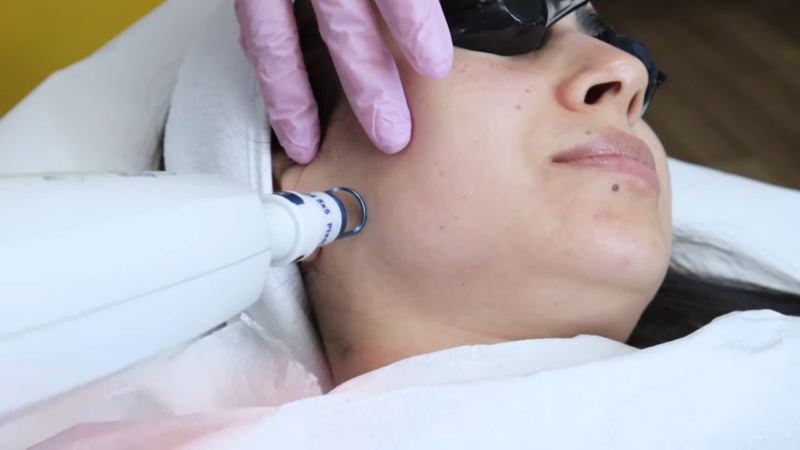 How Does Laser Treatment Work for Skin Rejuvenation? - Get Ldi