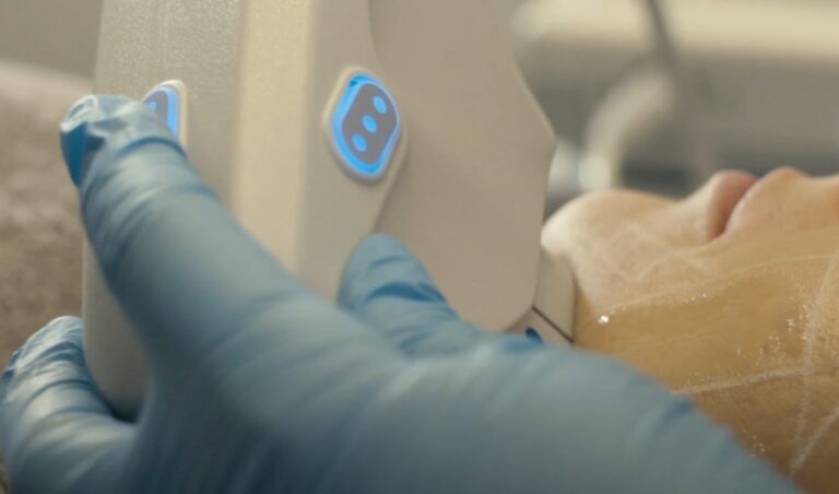 How Much Does Ultherapy Cost, and Is It Worth the Price? - Get Ldi